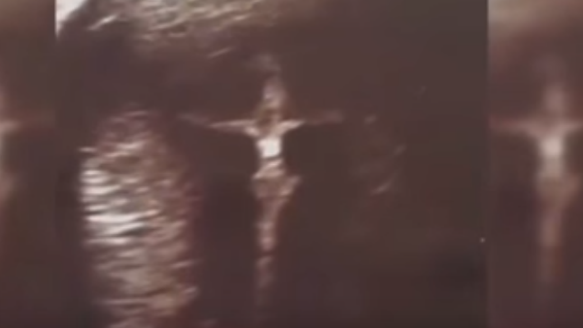 OMG महिला के गर्भ में पल रहे हैं जीसस, वायरल हुई यह फोटो | Holy ...