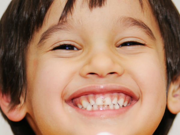 OMG 9 साल के बच्चे में मुंह में 32 नहीं 300 दांत | Meet A 9-Year-Old ...