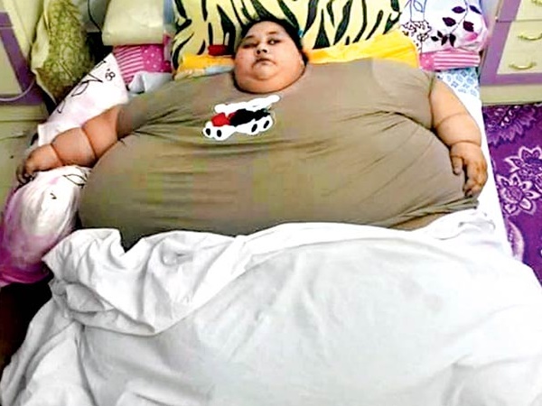 नहीं रही दुनिया की सबसे वजनी महिला इमान अहमद, मुंबई में चला था लंबा ...