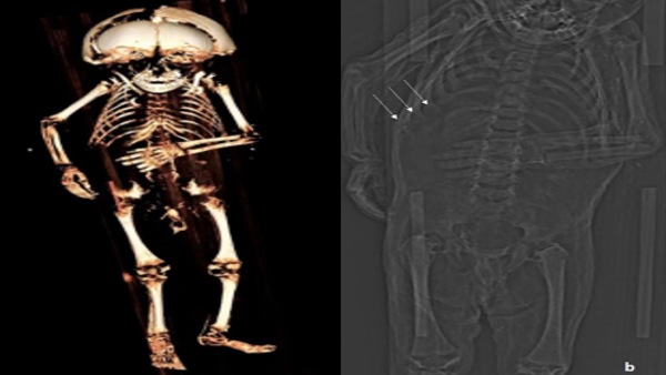 Mummified Baby: तहखाने में रखी 400 साल पुरानी बच्चे की 'ममी का राज ...