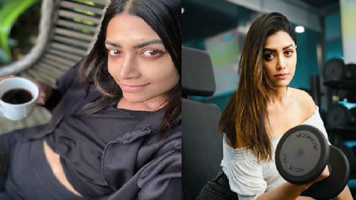 कैंसर के बाद अब इस गंभीर बीमारी का शिकार हुईं ममता मोहनदास, लोगों को दिखाई चेहरे की ऐसी हालत ...