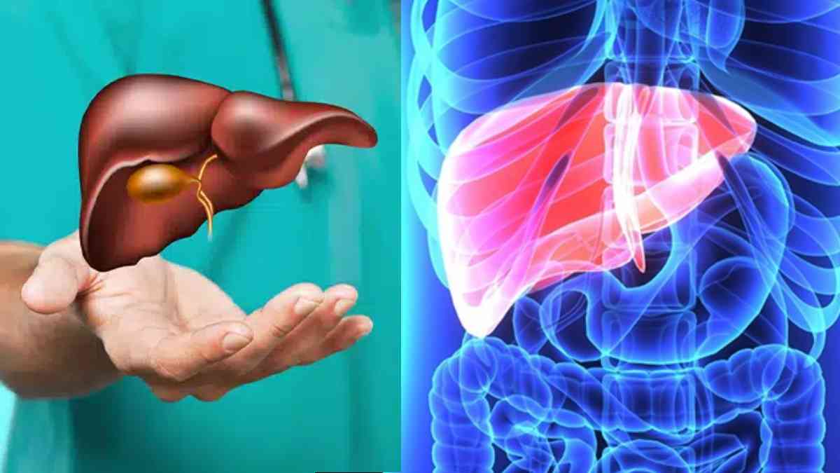 Liver Transplant: जानें लिवर ट्रांसप्लांट से जुड़ी हर जानकारी, ऑर्गन ...