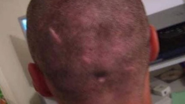 आश्चर्यजनक: शार्क ने गोताखोर को निगला, अचानक हुआ कुछ ऐसा वो बच निकला ...